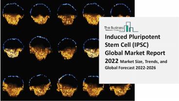 Induced Pluripotent Stem Cell (IPSC) Market 2022-2026 | Global Share ...