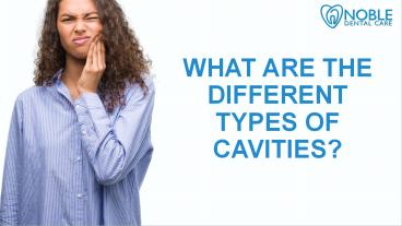 PPT – What Are the Different Types of Cavities? PowerPoint presentation ...