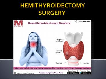 PPT – Hemithyroidectomy PowerPoint presentation | free to download - id ...