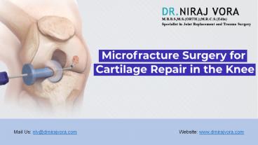 PPT – Microfracture Surgery for Cartilage Repair in the Knee | Dr Niraj ...