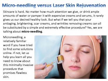 PPT – Micro-needling versus Laser Skin Rejuvenation PowerPoint ...