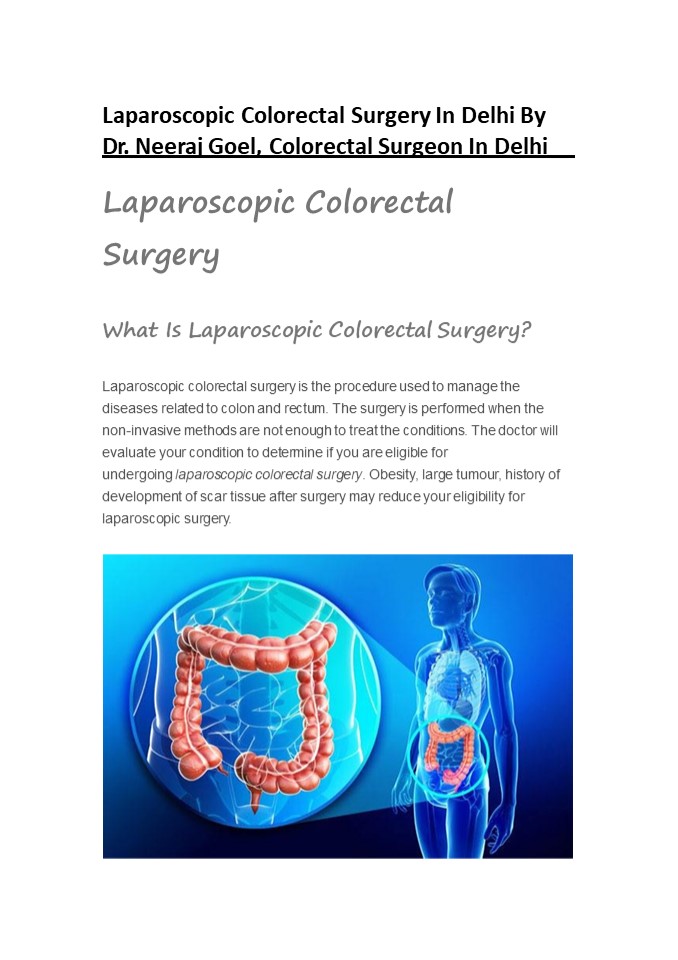 Laparoscopic Colorectal Surgery In Delhi By Dr. Neeraj Goel, Colorectal ...