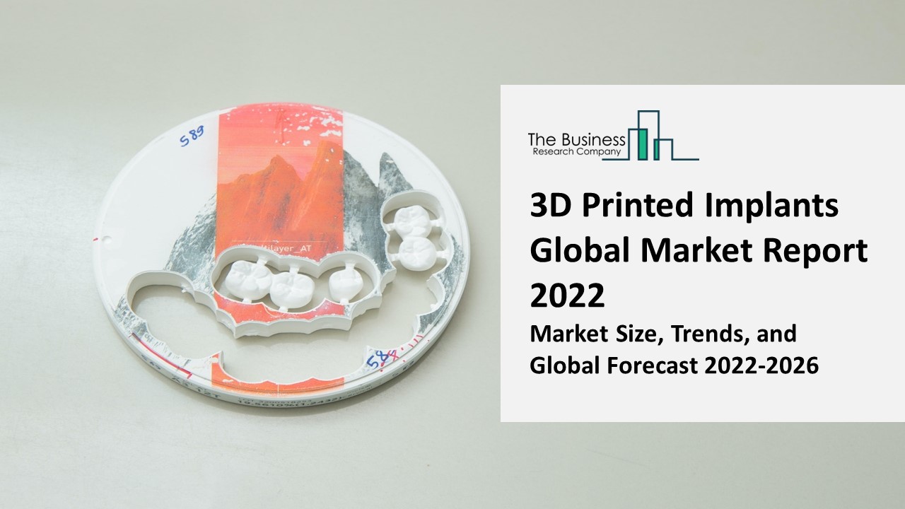 PPT – 3D Printed Implants Market 2022 - CAGR Status, Key Major Players ...