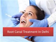 PPT – Root Canal Treatment in Tricity PowerPoint presentation | free to ...