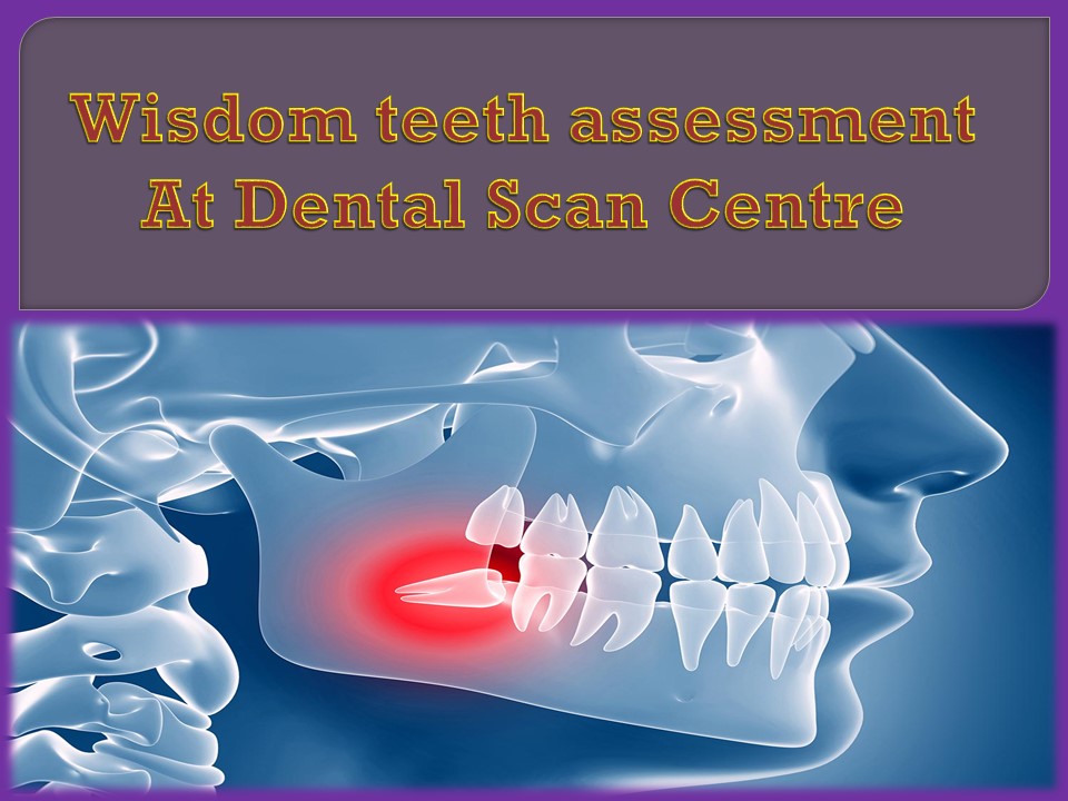 PPT – Wisdom teeth assessment At Dental Scan Centre PowerPoint ...