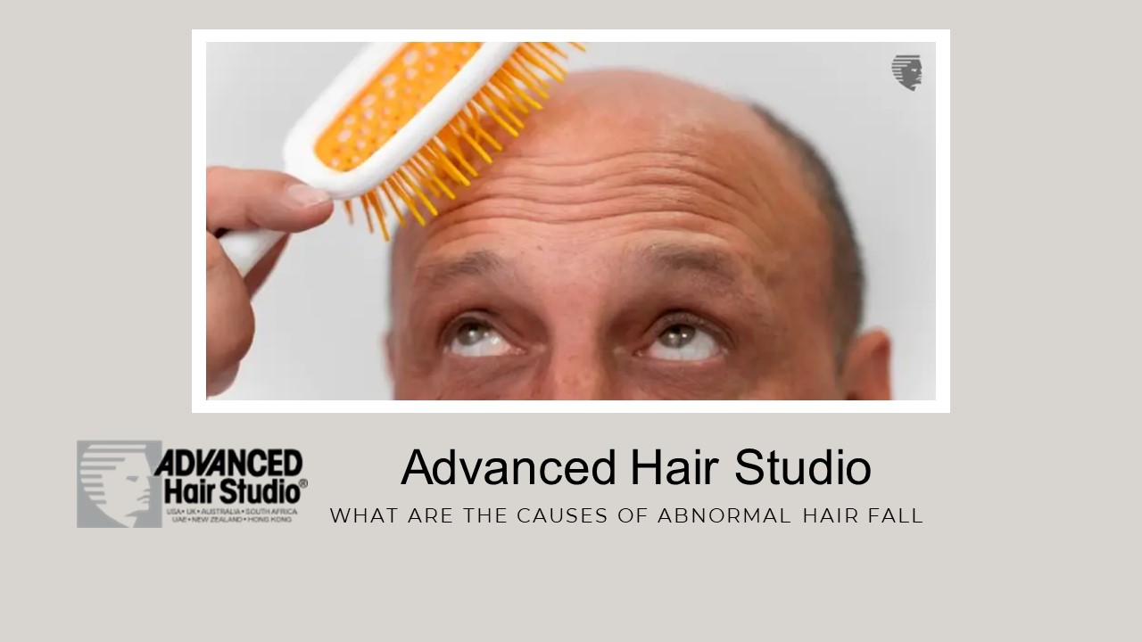 PPT – Know causes of abnormal hair loss and hair loss treatment ...