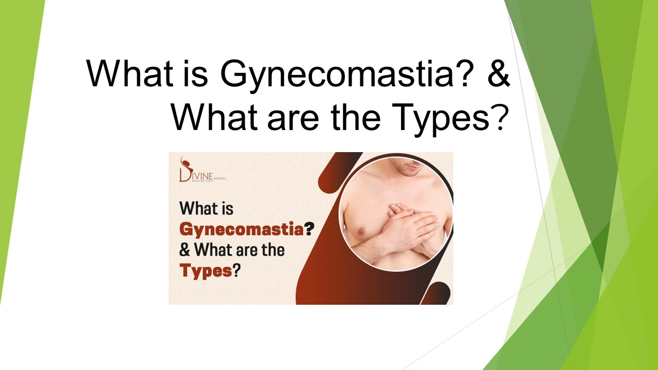 What is Gynecomastia & What are the Types presentation | free to download