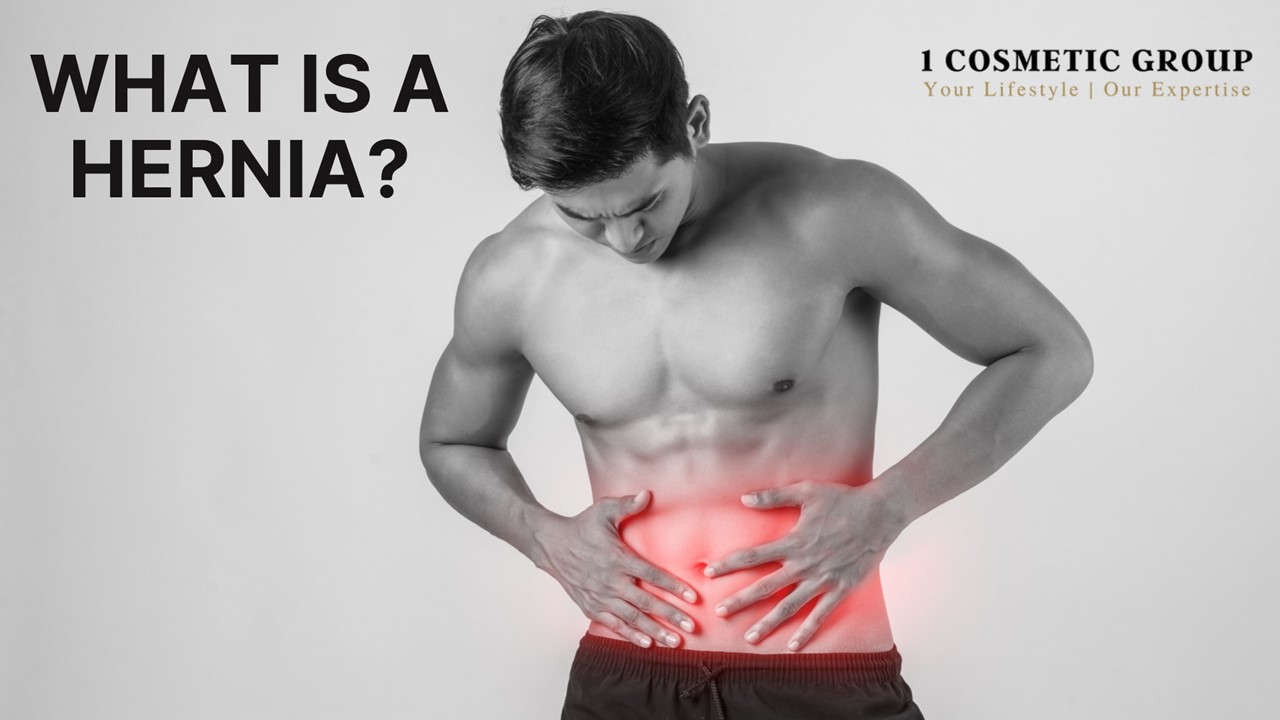 PPT – What is a hernia? PowerPoint presentation | free to download - id ...