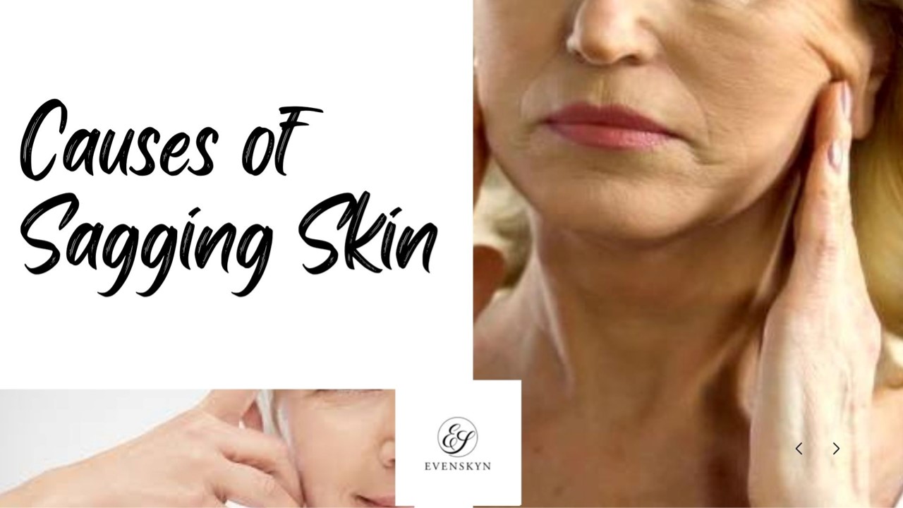 Causes of Sagging Skin presentation | free to download