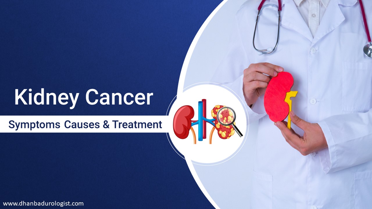 PPT – Kidney Cancer PowerPoint presentation | free to download - id ...