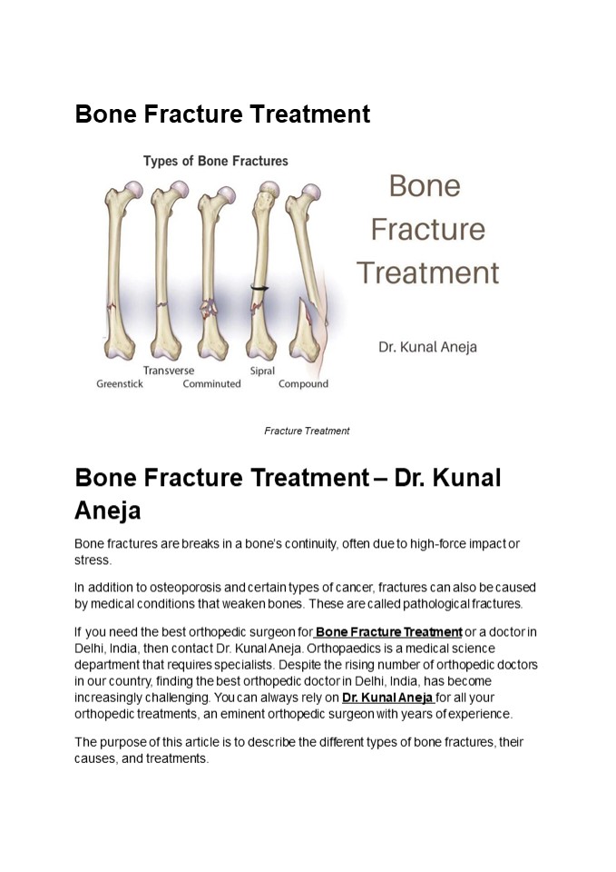 Bone Fracture Treatment – Dr. Kunal Aneja presentation | free to download