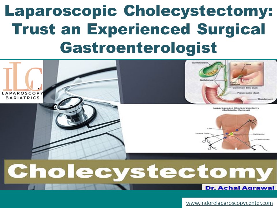 PPT – Laparoscopic Cholecystectomy: Trust an Experienced Surgical ...