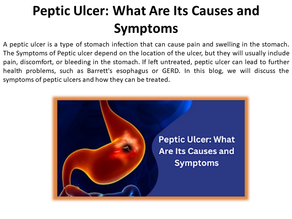 What Signs and Symptoms Indicate a Peptic Ulcer? presentation | free to ...