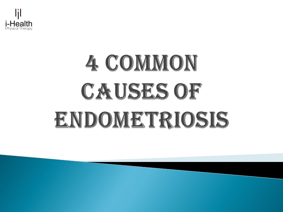 PPT – 4 Common Causes OF Endometriosis PowerPoint presentation | free ...