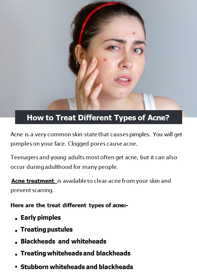 How to Treat Different Types of Acne? presentation | free to download