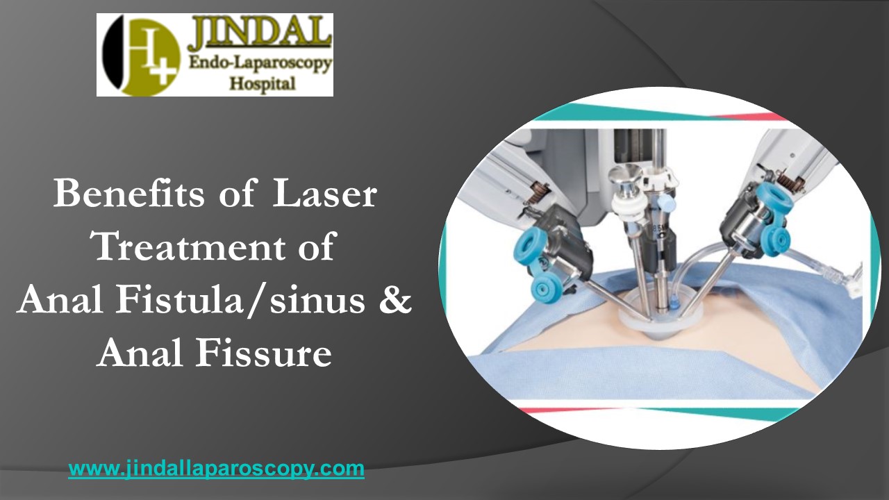 Benefits of Laser Treatment of Anal Fistula/sinus & Anal Fissure presentation | free to download