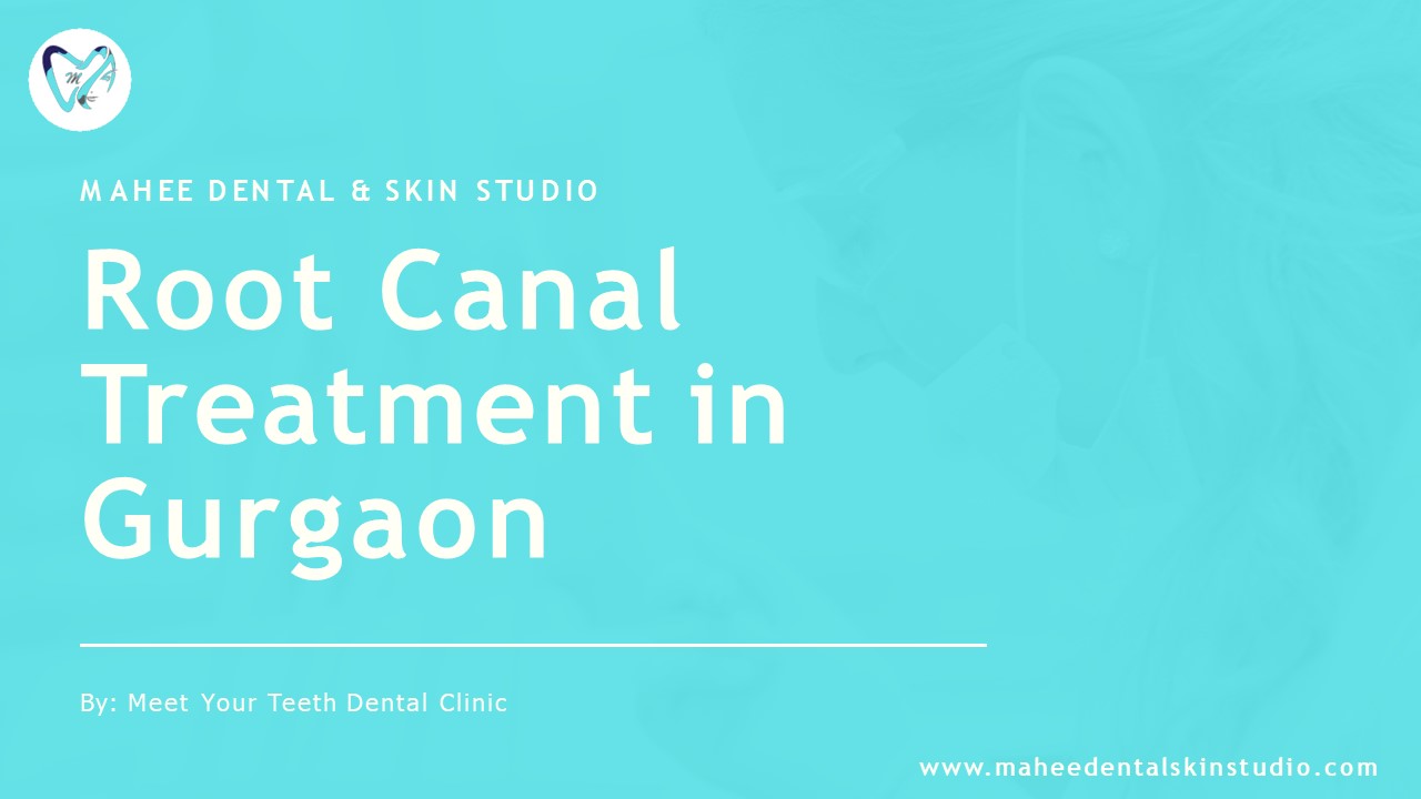 PPT – Root Canal Treatment in Gurgaon (1) PowerPoint presentation | free to download - id ...