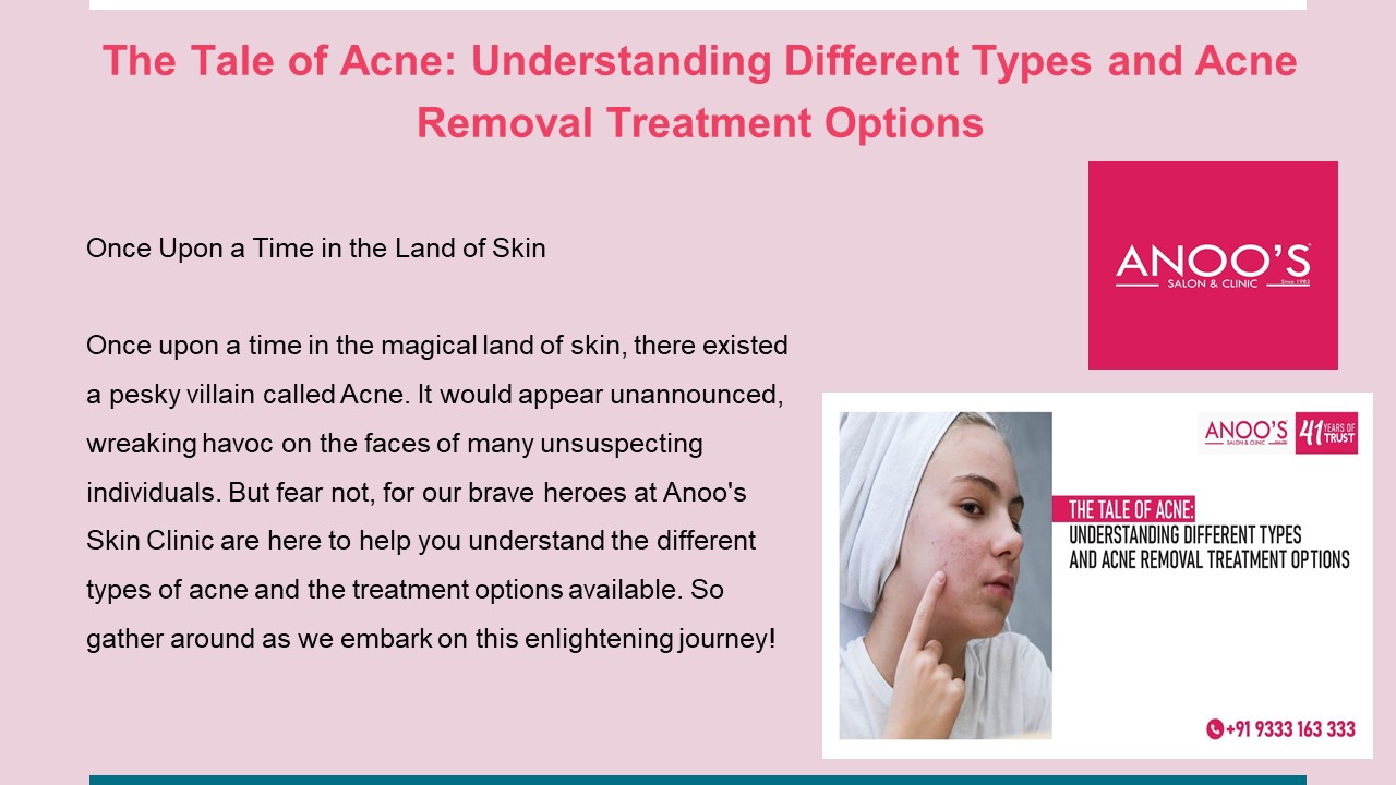 The Tale of Acne: Understanding Different Types and Acne Removal ...