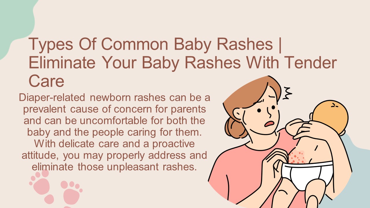 PPT – Types Of Common Baby Rashes | Eliminate Your Baby Rashes With ...