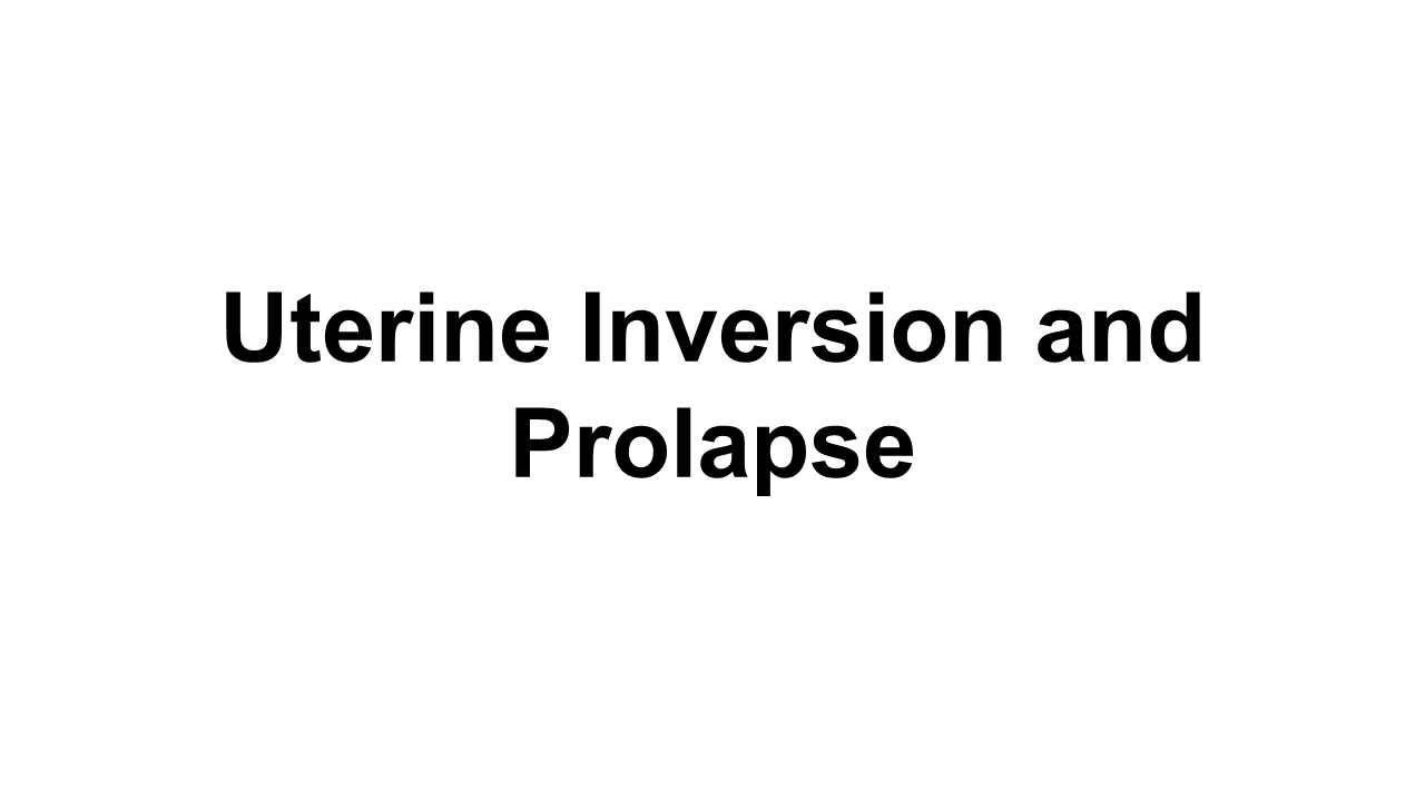uterine inversion and prolapse presentation | free to download