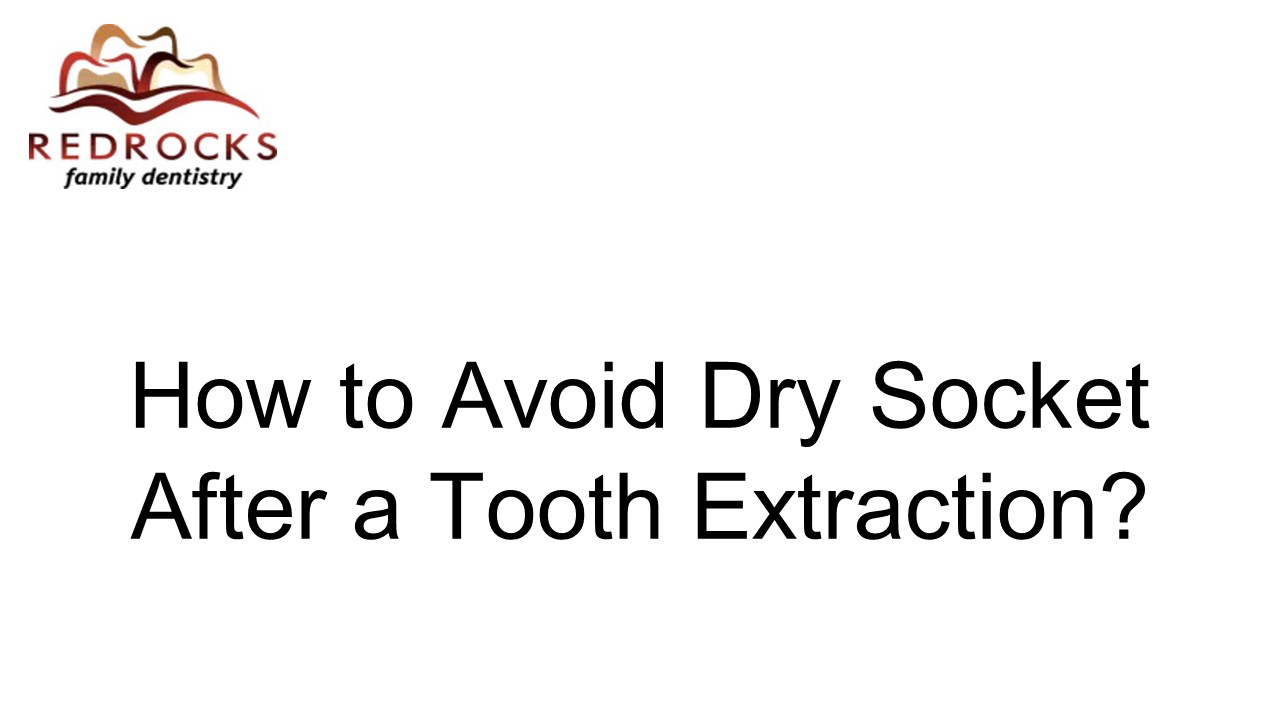 How to Avoid Dry Socket After a Tooth Extraction | Red Rocks Family ...