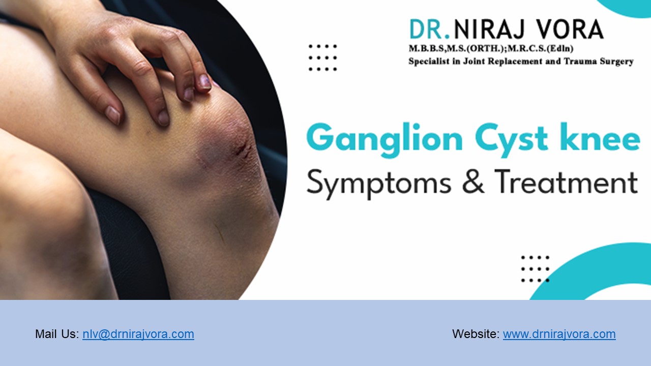 Ganglion Cyst Knee Symptoms and Treatment | Dr Niraj Vora presentation ...