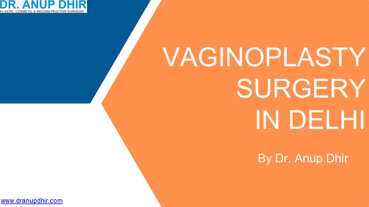 Vaginoplasty Surgery In Delhi Dr Anup Dhir Presentation Free To