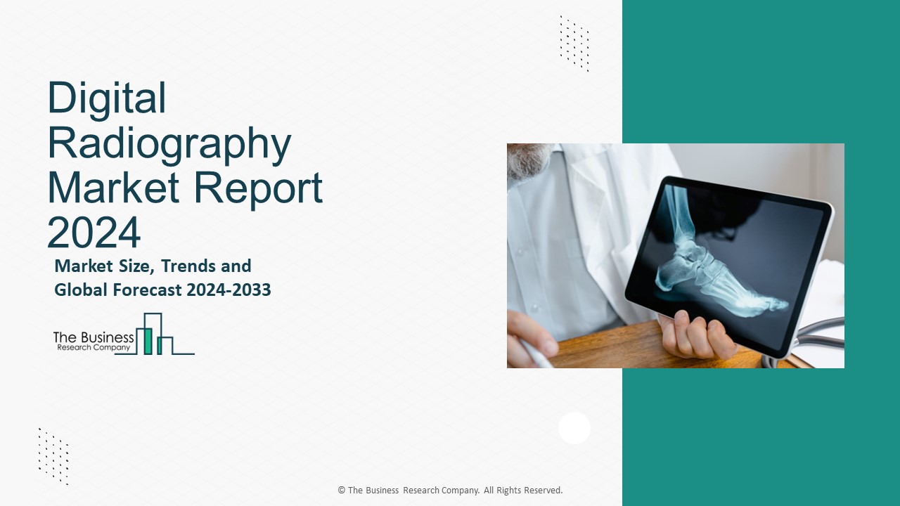 PPT – Digital Radiography Market 2024 - By Size, Share, Segments ...