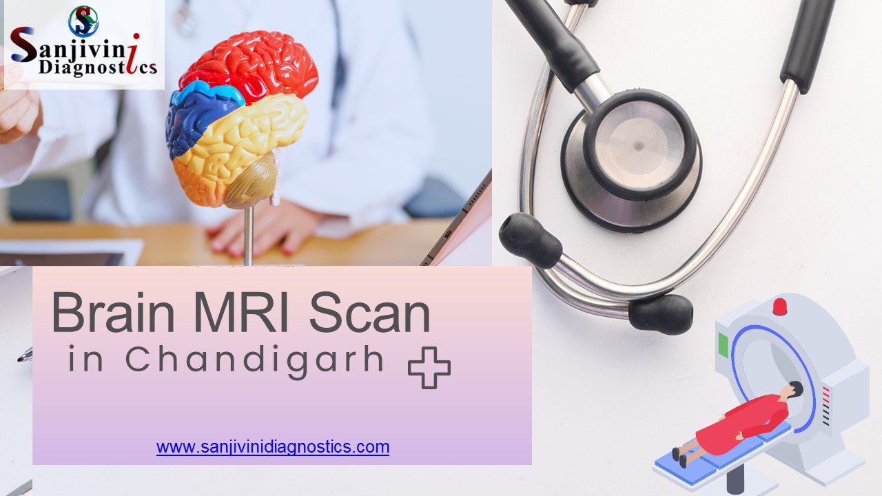Top Brain MRI Scan Services in Chandigarh - Sanjivini Diagnostics: Understanding Brain MRI, its ...