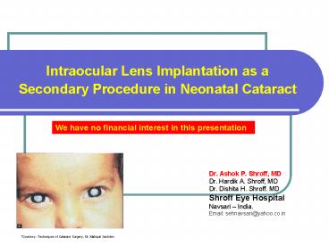 Intraocular Lens Implantation as a Secondary Procedure in Neonatal ...