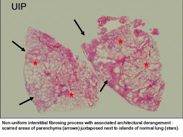 UIP presentation | free to view