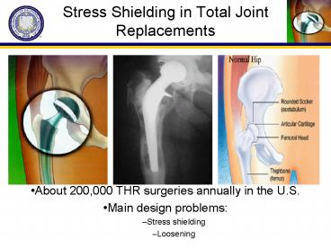 Stress Shielding in Total Joint Replacements presentation | free to view