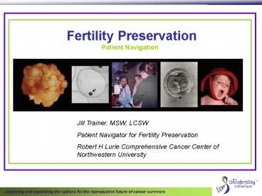 PPT – Fertility Preservation PowerPoint presentation | free to view ...