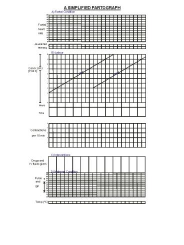 A SIMPLIFIED PARTOGRAPH presentation | free to view