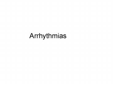 PPT – Arrhythmias PowerPoint presentation | free to view - id: 1b0d6d-ZDc1Z