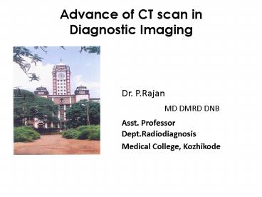 Advance of CT scan in Diagnostic Imaging presentation | free to view