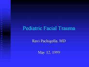 PPT – Facial Fractures PowerPoint presentation | free to view - id ...