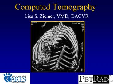Computed Tomography presentation | free to view