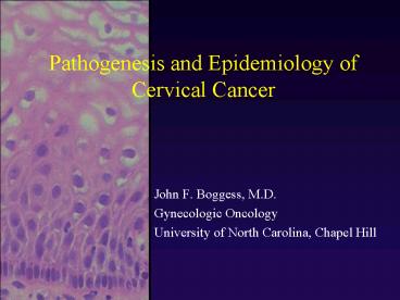 Pathogenesis and Epidemiology of Cervical Cancer presentation | free to ...
