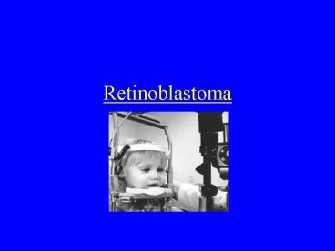 Retinoblastoma presentation | free to view