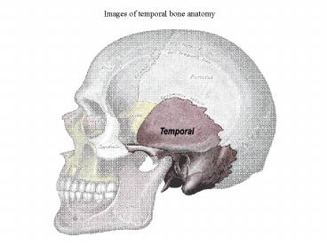 Images of temporal bone anatomy presentation | free to view