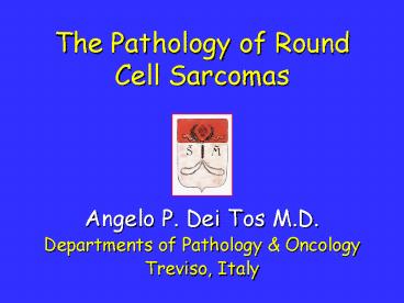 PPT – The Pathology of Round Cell Sarcomas PowerPoint presentation ...