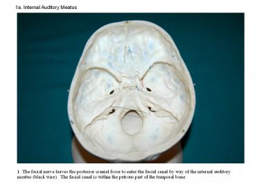 1a. Internal Auditory Meatus presentation | free to download