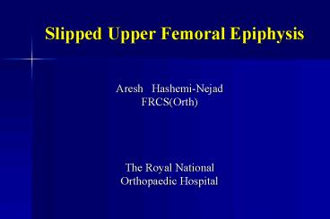 Slipped Upper Femoral Epiphysis presentation | free to view