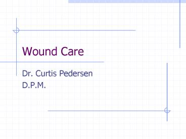 PPT – Wound Care PowerPoint presentation | free to view - id: 1c06be-NjczN
