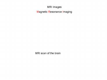 PPT – MRI Images PowerPoint presentation | free to view - id: 21259a-NzJiN