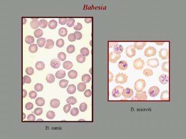 Babesia presentation | free to view