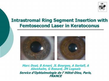 Intrastromal Ring Segment Insertion with Femtosecond Laser in ...