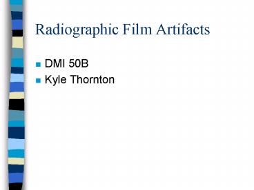 Radiographic Film Artifacts presentation | free to view