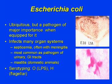 Escherichia coli presentation | free to view